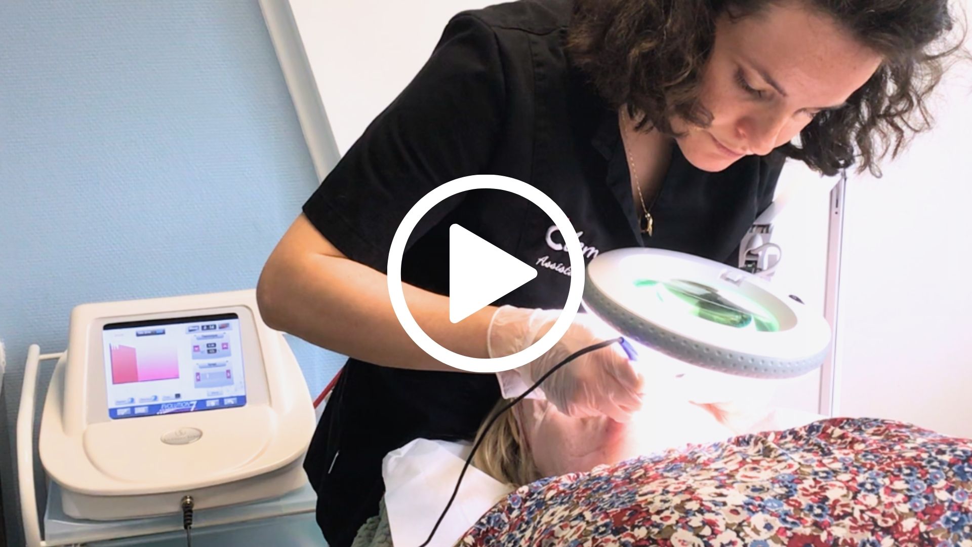 Vidéo - Épilation électrique ou électrolyse pour les poils du visage - CLEM